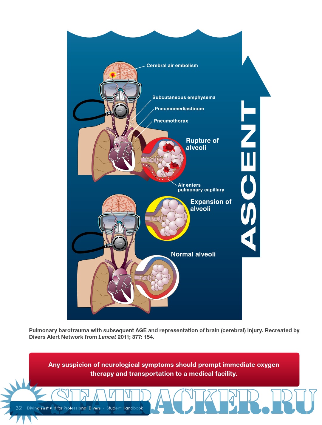 Diving First Aid for Professional Divers - Brownell B. [2021, PDF ...